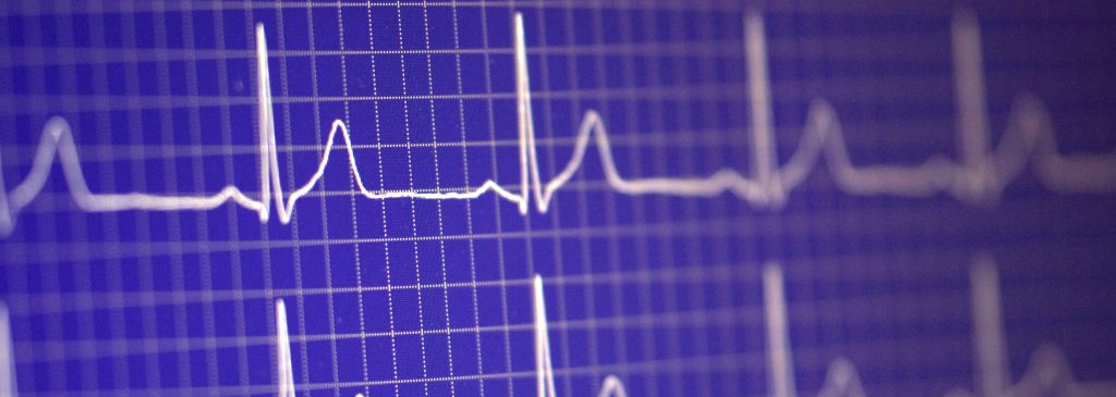 Ruhe-EKG - kardiologie-schlachtense.de